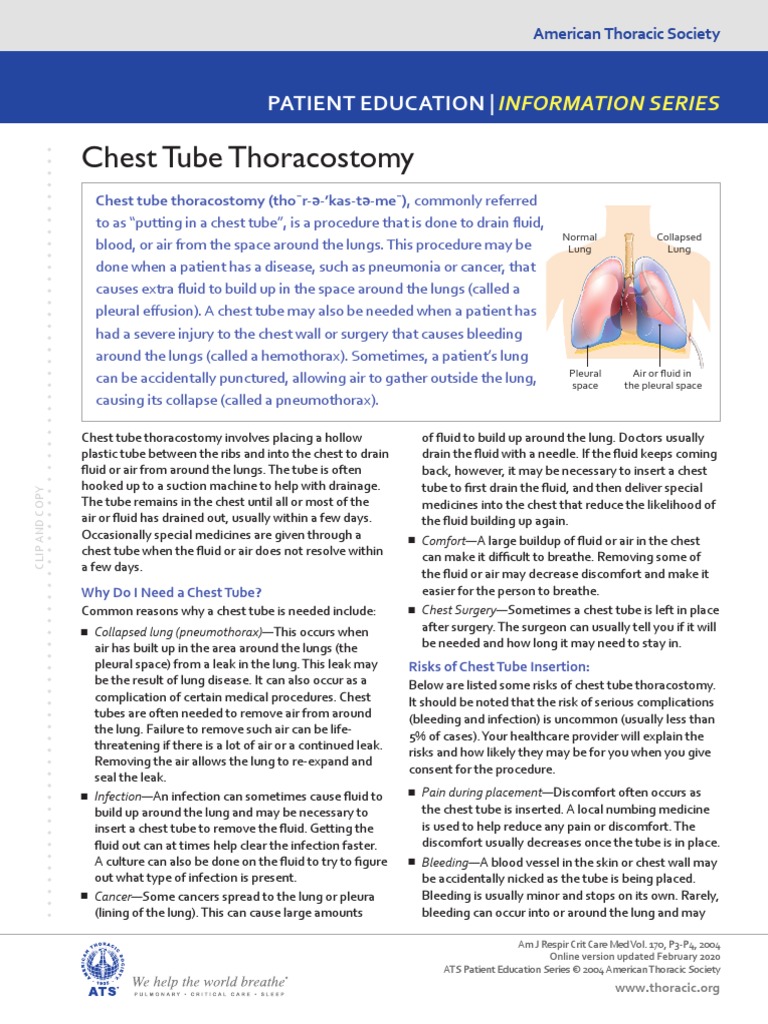 Chest Tube Thoracostomy: Patient Education | PDF | Thorax | Surgery