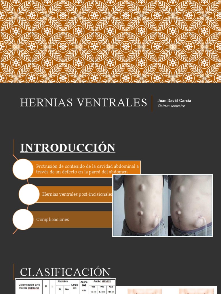 Hernias de Pared Abdominal | PDF | Abdomen | Ciencias de la Salud