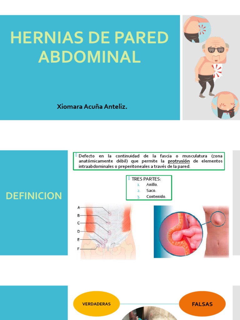 Hernias de Pared Abdominal | PDF | Abdomen | Enfermedades y trastornos