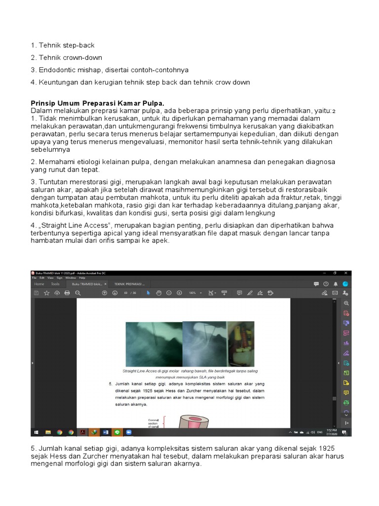 Step Back Dan Crown Down | PDF