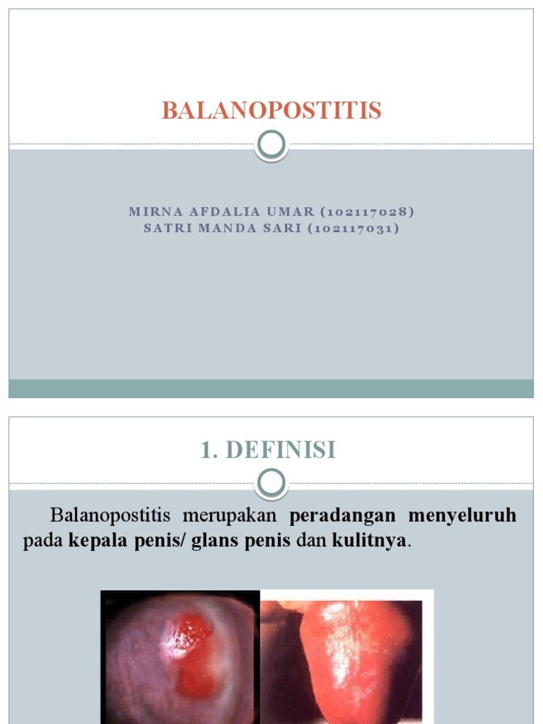 Balanopostitis: Definisi dan Penanganan | PDF
