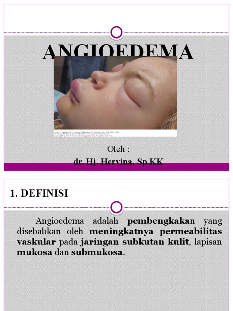 Angioedema | PDF