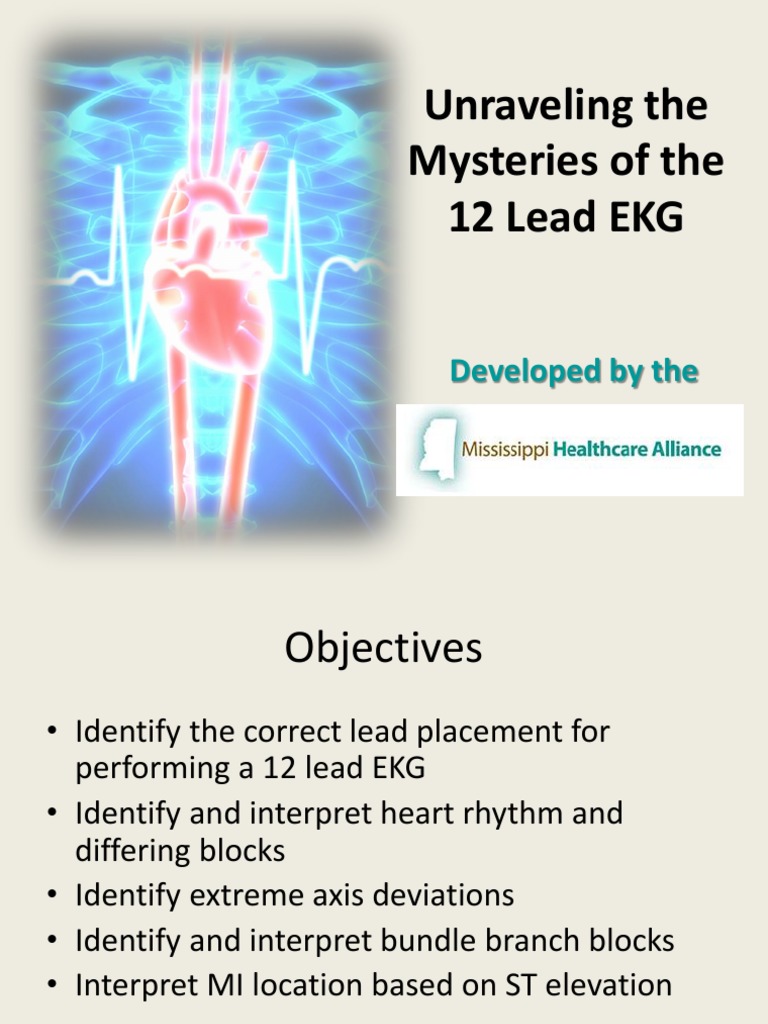 12 Lead EKG Interpretation PDF | PDF | Electrocardiography | Myocardial ...
