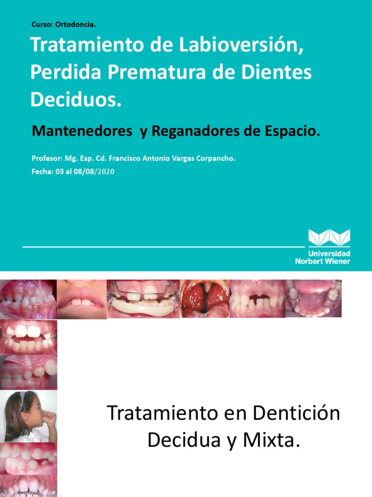 Tratamiento de Labioversion Perdida Prematura de Dientes PDF | PDF ...