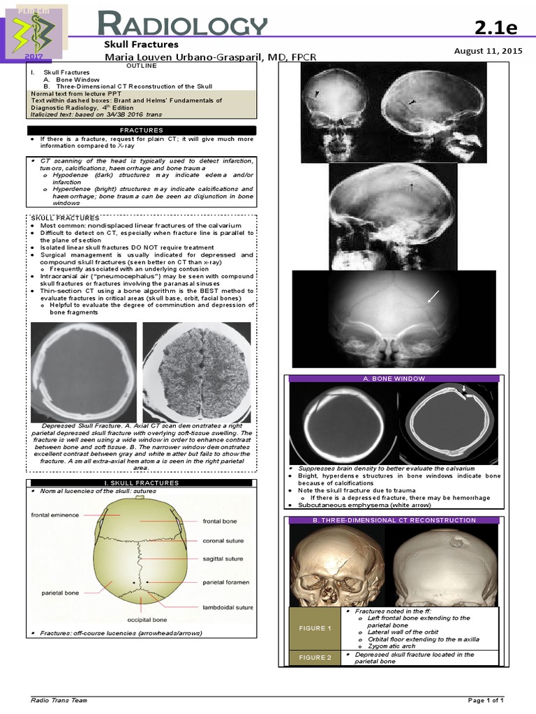 RADIOLOGY 2.1e Skull Fractures | PDF | Ct Scan | Skull