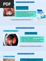 Panduan Praktik Klinis Cervicitis | PDF