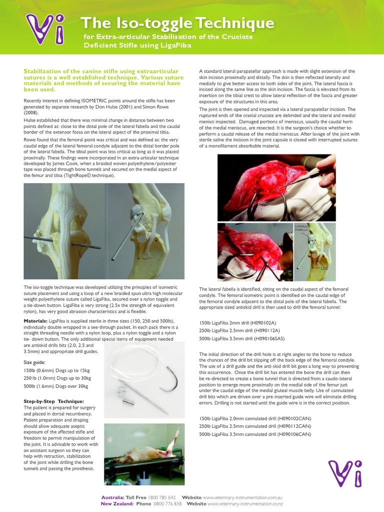 The Iso-Toggle Technique: For Extra-Articular Stabilisation of The ...
