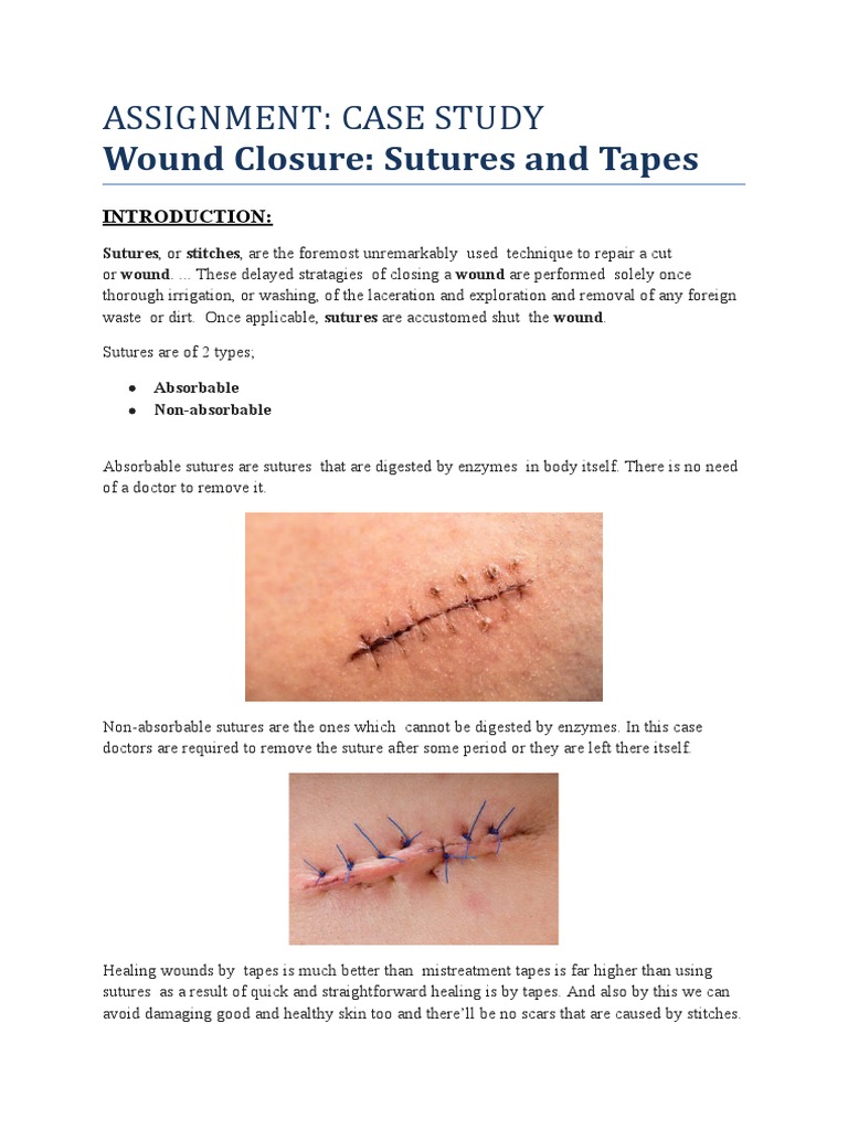 Case Study Wound Healing | PDF | Wound Healing | Healing