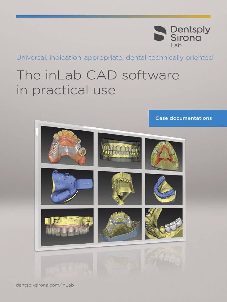 LAB Brochure Inlab User Case Documentations en PDF | PDF | 3 D Printing ...