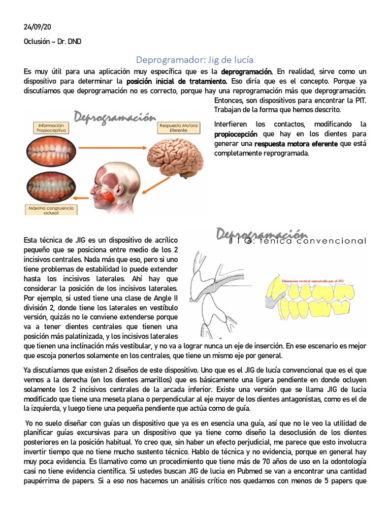 Jig de Lucía: Técnica y Aplicaciones | PDF | Pintura acrilica | Boca