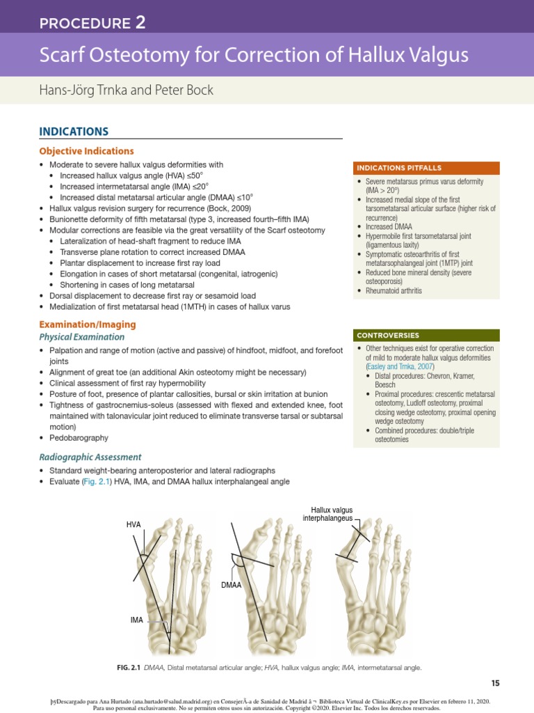 Scarf Osteotomy For Correction of Hallux Valgus: Hans-Jörg Trnka and ...