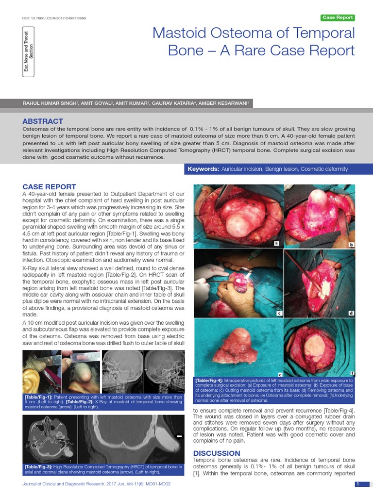 Mastoid Osteoma of Temporal Bone - A Rare Case Report | PDF | Bone | Skull