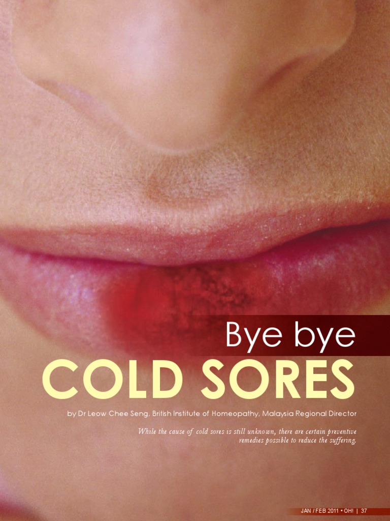 Health+Jan Feb+11+Cold+Sores,+Dr+Leow | PDF | Health Sciences ...