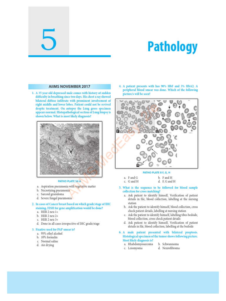 Pathology AIIMS | PDF | Anemia | Lymphoma