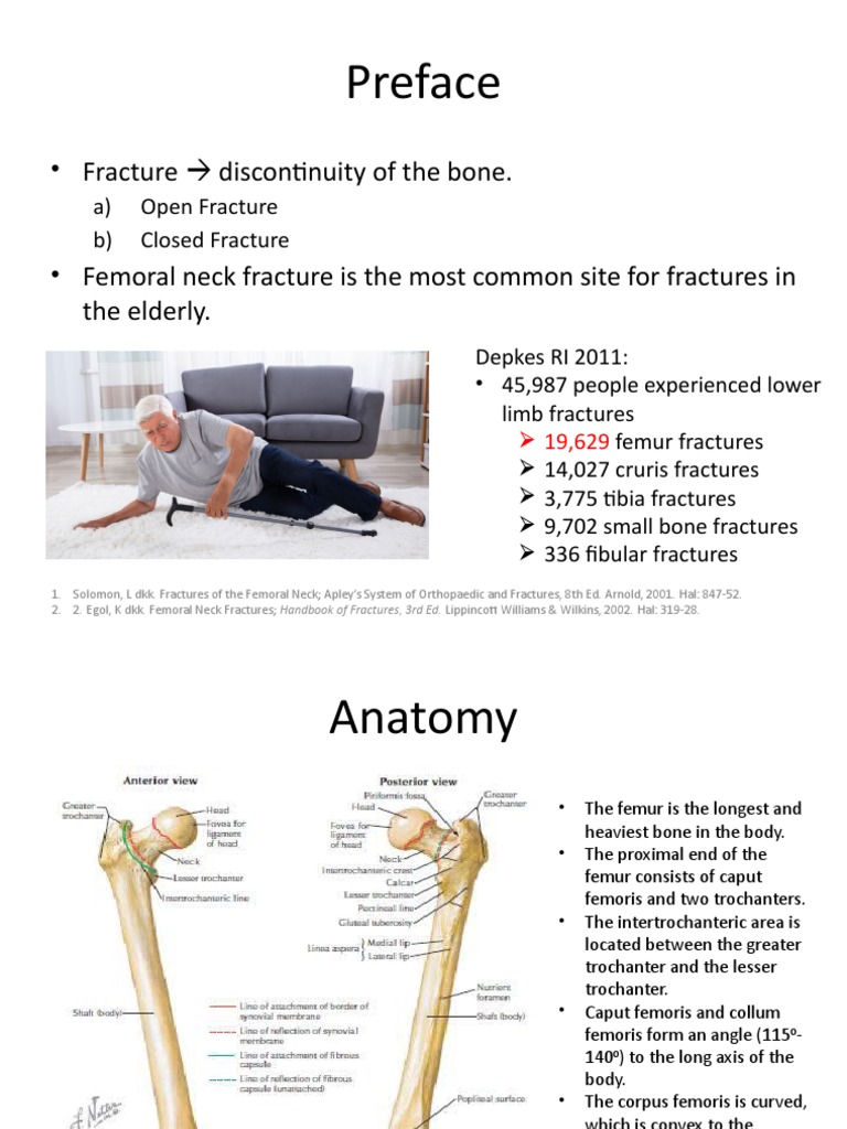 Preface: - Fracture Discontinuity of The Bone | Download Free PDF ...
