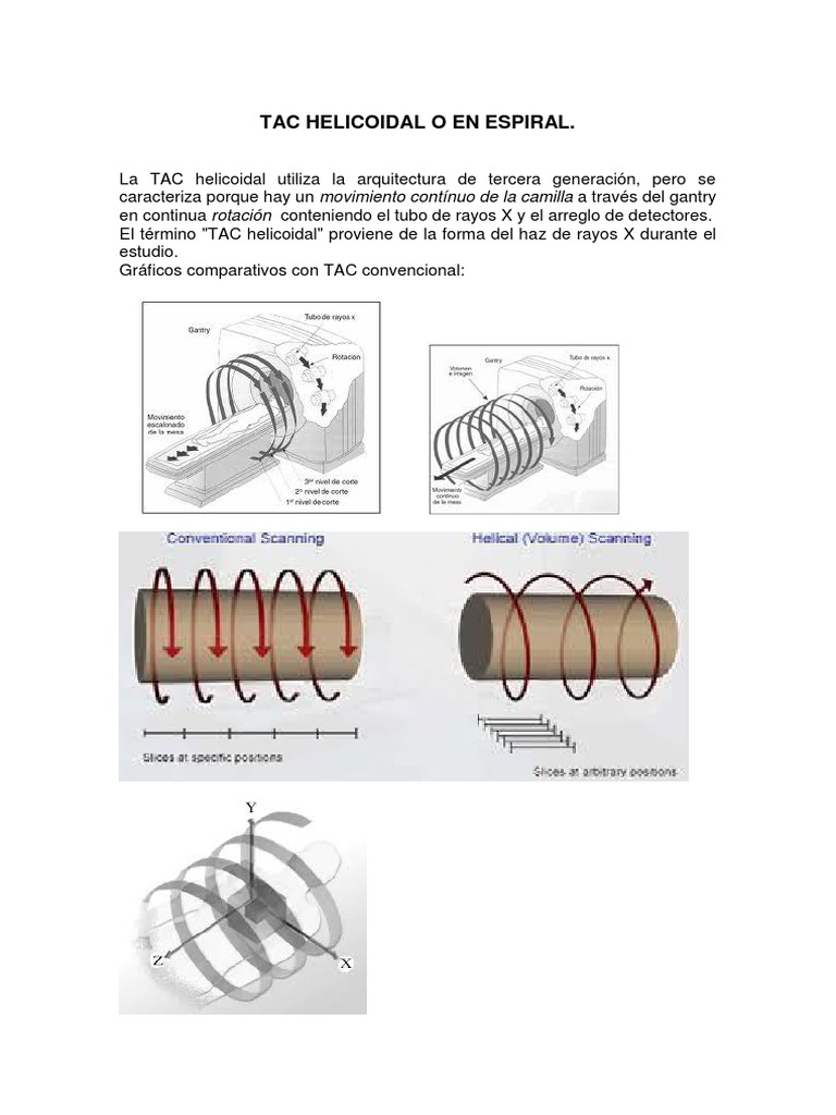 TC Helicoidal PDF | PDF | Ct Scan | Segmentación de imagen