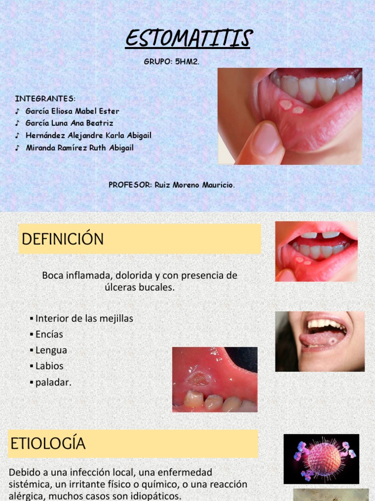 ESTOMATITIS | PDF | Gastroenterología | Especialidades Medicas