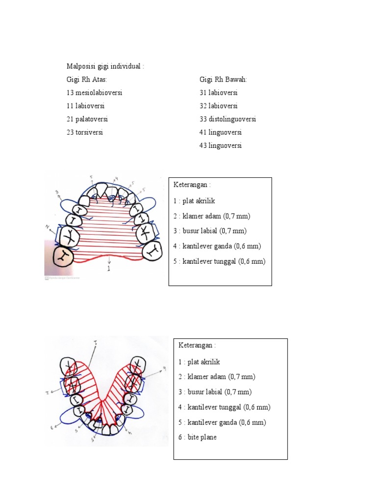 Malposisi Gigi Individual | PDF