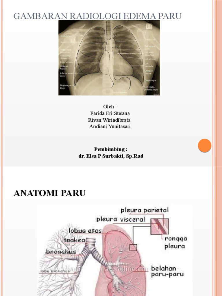 Gambaran Radiologi Edema Paru | PDF