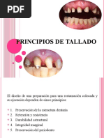 Tipos de Líneas de Terminación Dental | PDF | Dentadura postiza | Diente