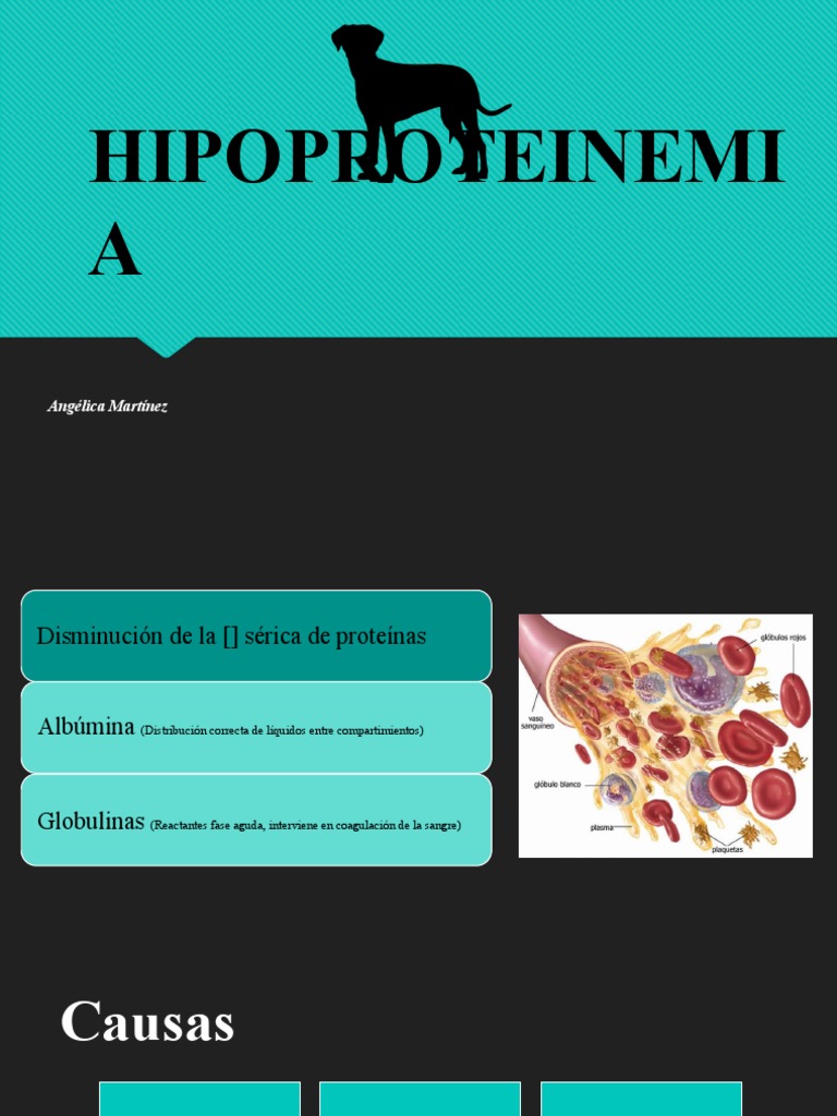 HIPOPROTEINEMIA | PDF | Edema | Especialidades Medicas