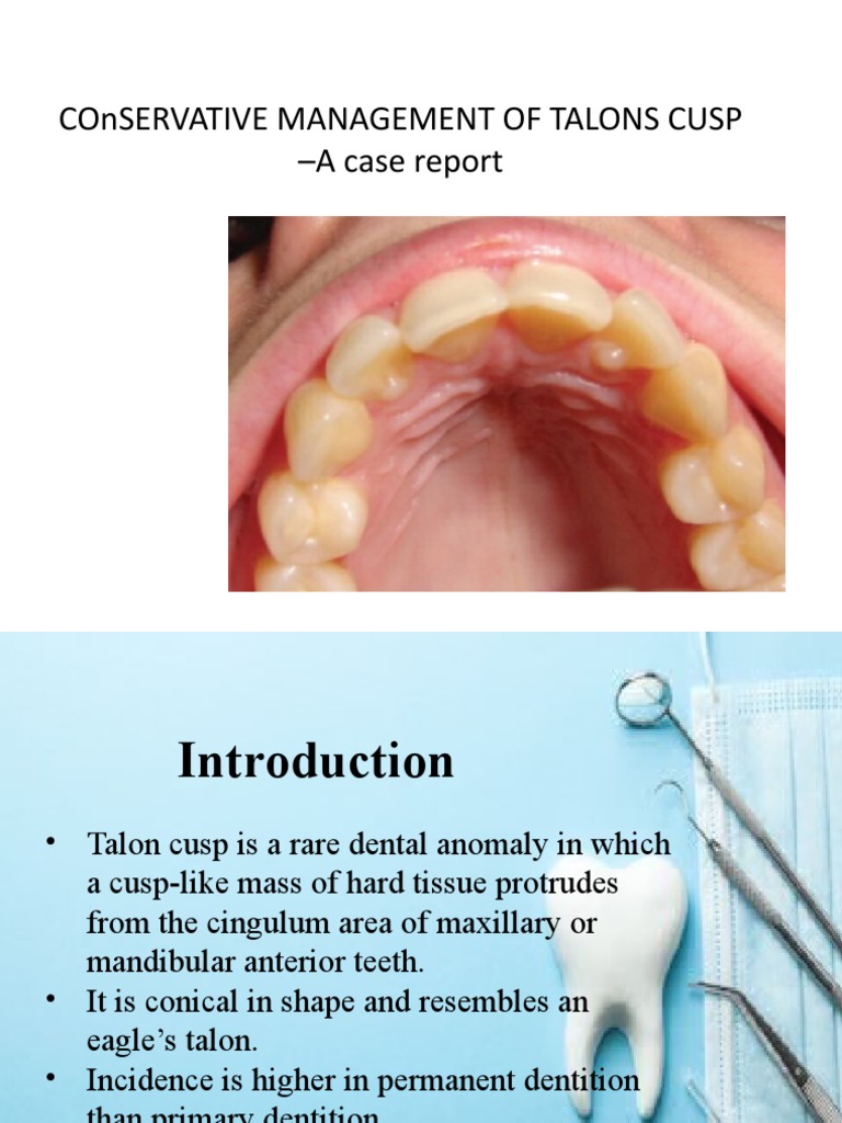 Conservative Management of Talon's Cusp-A Case Report | Human Tooth ...