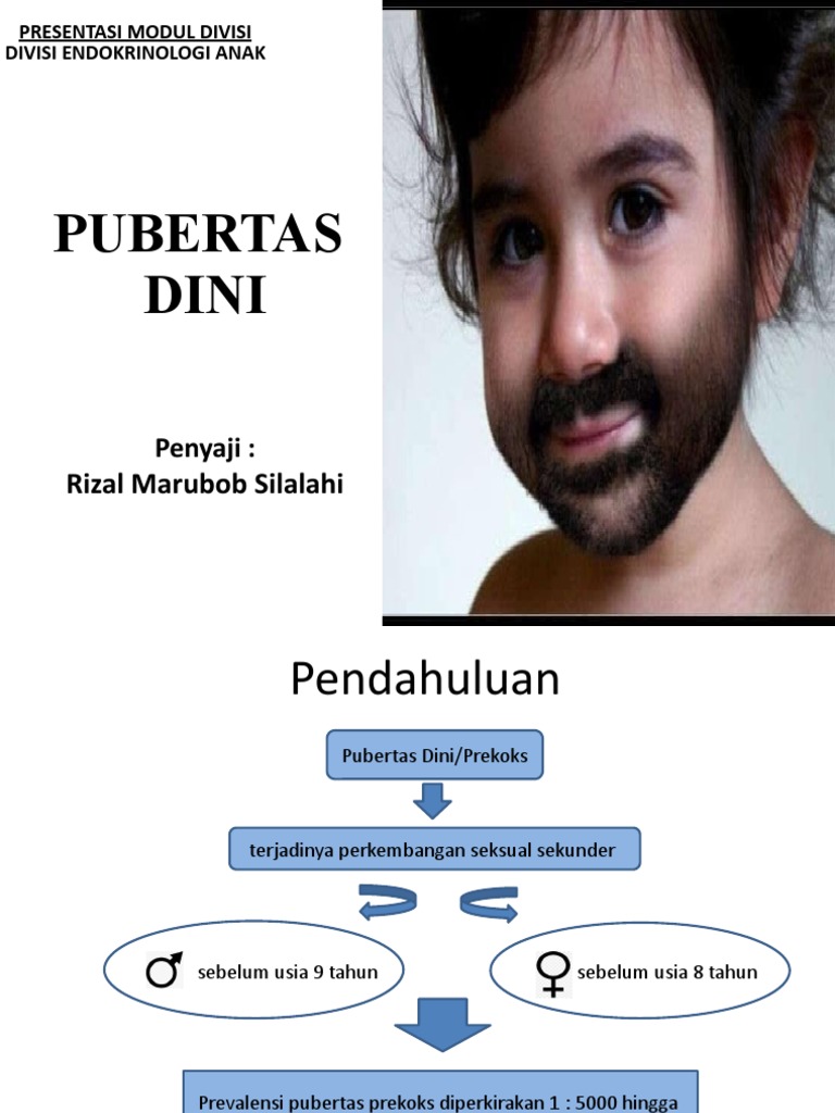 Present Endokrinologi RMS Pubertas Dini 2 | PDF