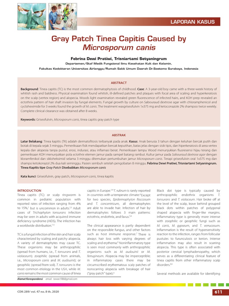Gray Patch Tinea Capitis Caused by Microsporum Canis PDF | PDF | Fungus ...