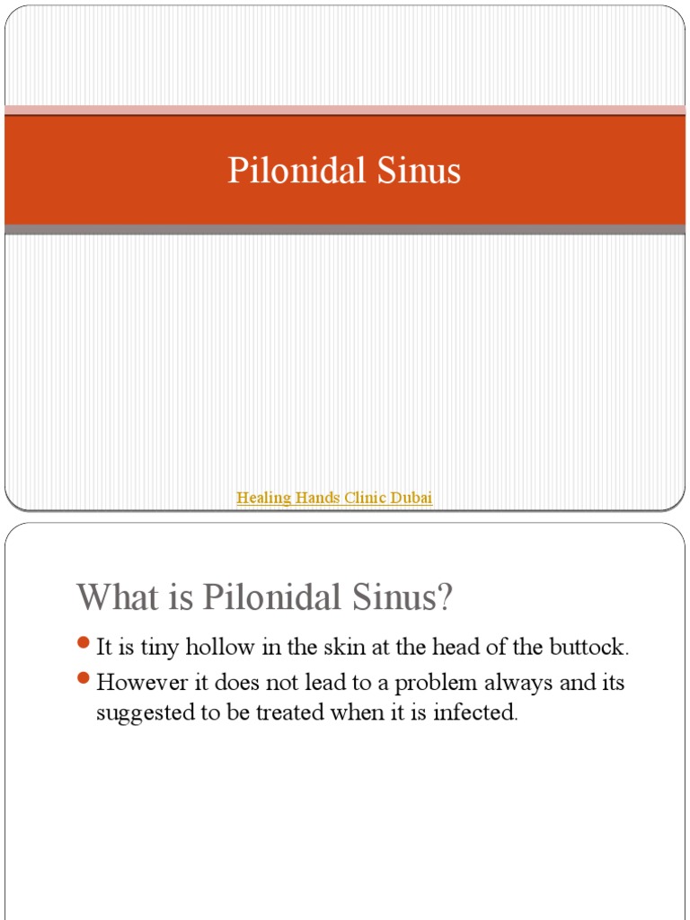 Pilonidal Sinus Treatment Dubai | PDF | Science & Mathematics