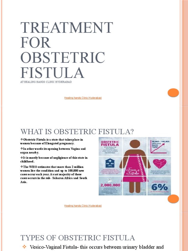 Treatment for Obstetric Fistula | PDF | Vagina | Sexual Anatomy