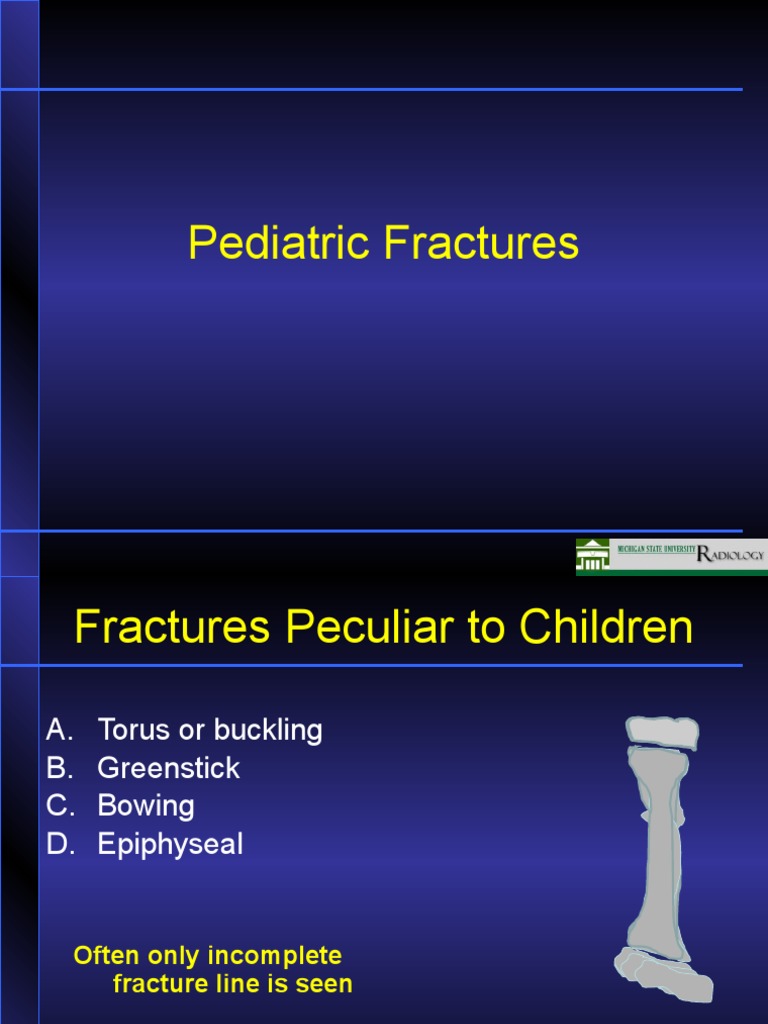 Pediatric Fracture | PDF