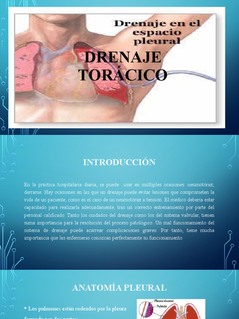 Guía completa sobre el drenaje torácico: indicaciones, procedimiento ...