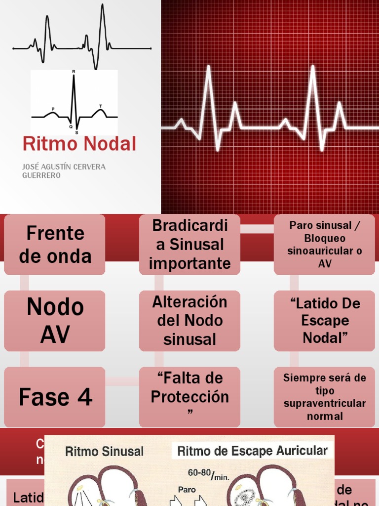 Ritmo Nodal | PDF | Enfermedades cardiovasculares | Arritmia cardiaca