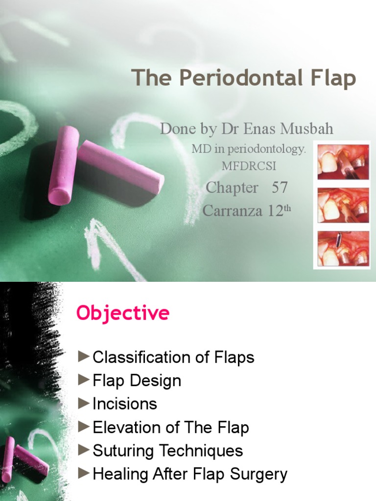 Periodontal Flap Surgery Overview | PDF | Periodontology | Bone
