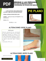 Pie Talo, Pie Varo, Valgo, y Pie Plano | PDF | Pie | Tobillo