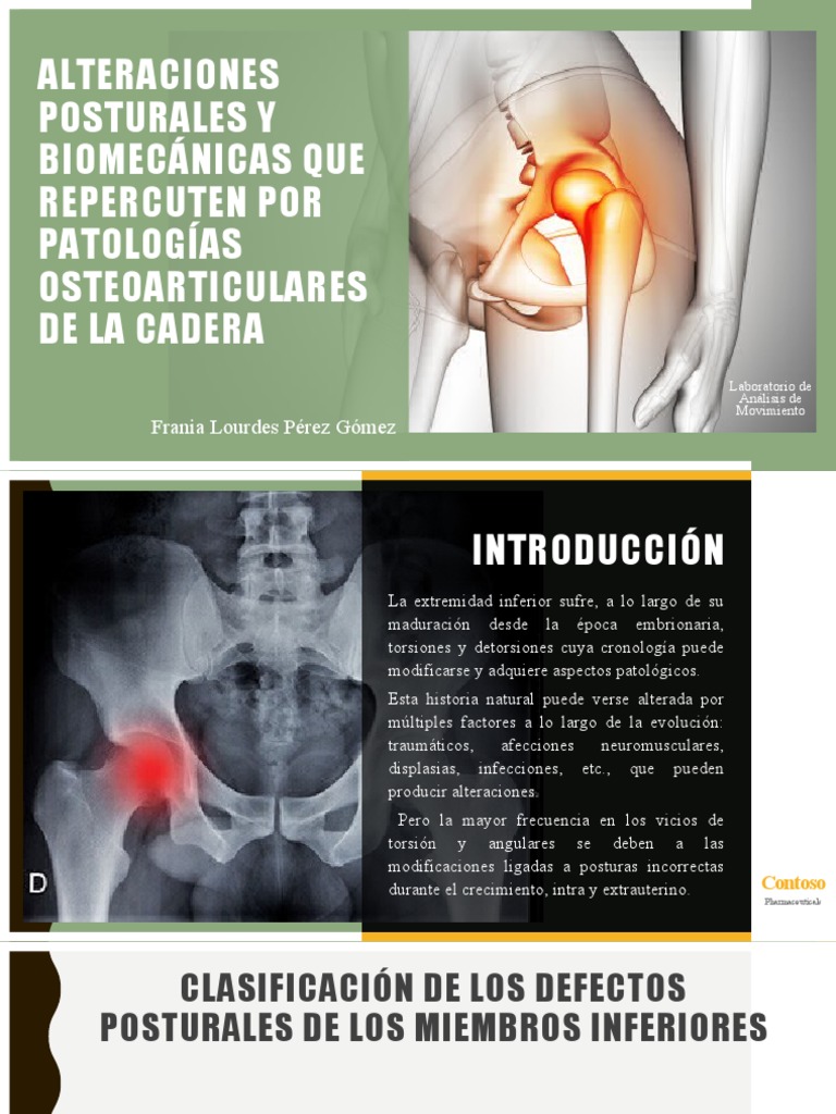 Alteraciones posturales y biomecánicas de la cadera: una revisión de ...