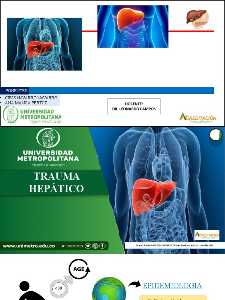Trauma Hepatico. | PDF | Lesión | Hígado