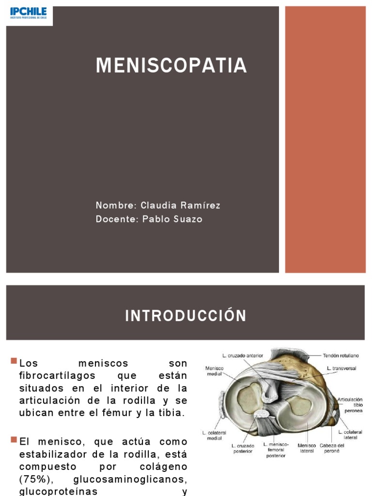 Meniscopatía | PDF | Rodilla | Extremidades (anatomía)
