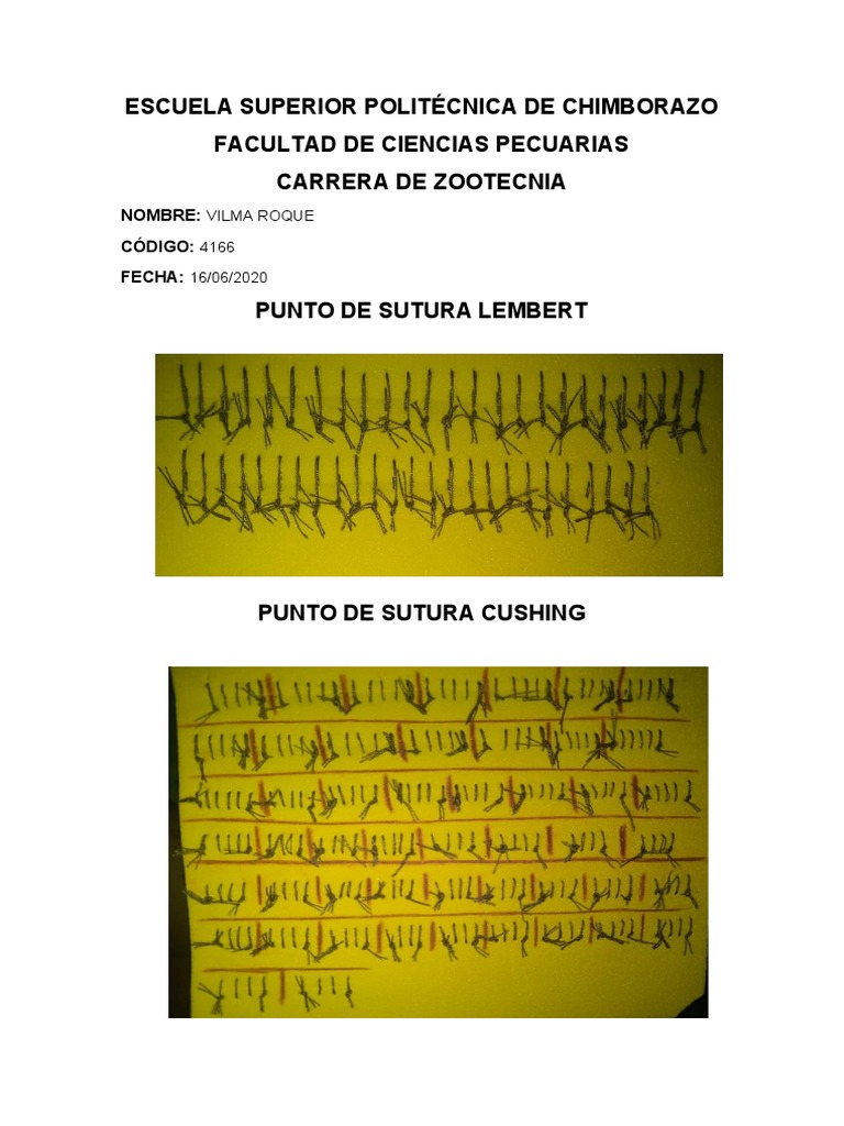 Puntos de sutura Cushing y Lembert | PDF