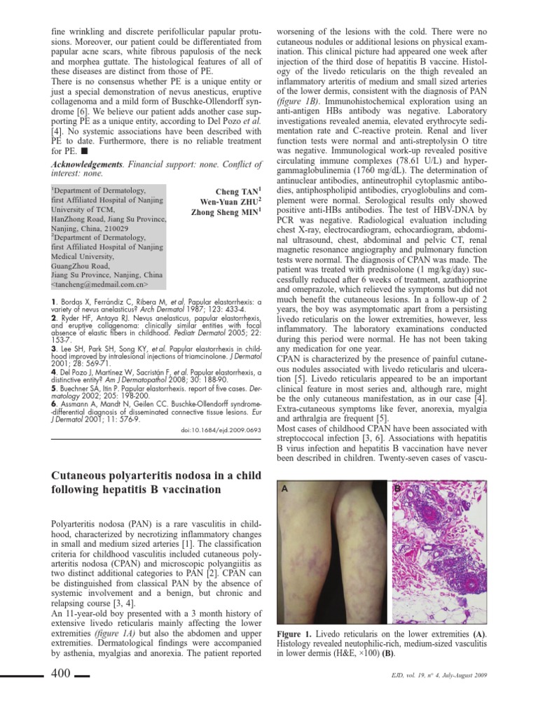 Cutaneous Polyarteritis Nodosa in A Child Followin | PDF | Metastasis ...