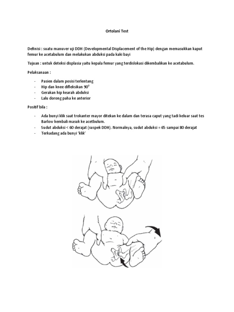 Ortolani Test | PDF
