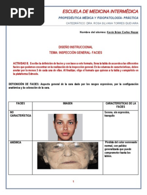 Facies Marcha