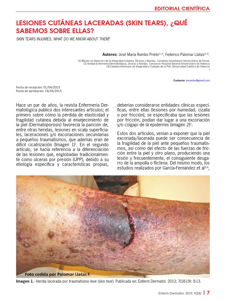 Lesiones cutáneas laceradas: skin tears | PDF | Herida | Lesión