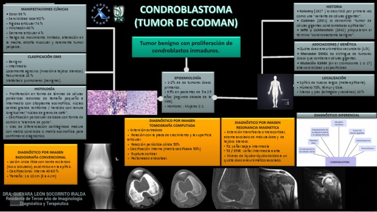 Condroblastoma: diagnóstico y características | PDF | Neoplasias | Hueso