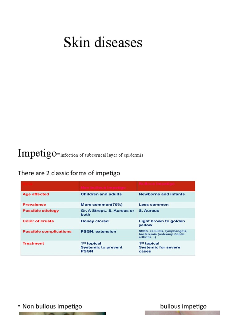 Skin Diseases Presentation | PDF | Dermatitis | Immunology