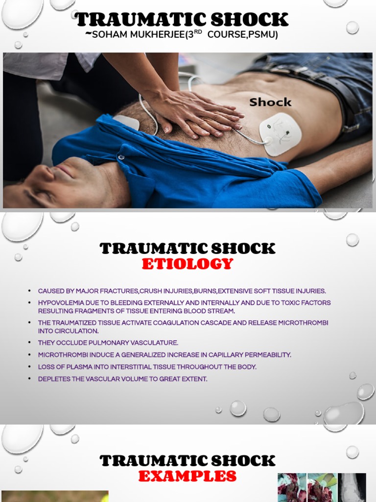 Traumatic Shock | PDF | Major Trauma | Shock (Circulatory)