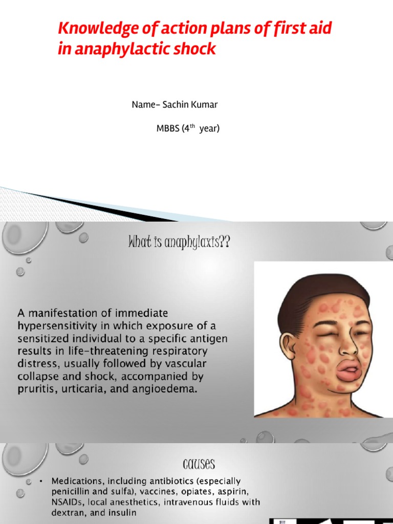 Anaphylactic Shock and First Aid