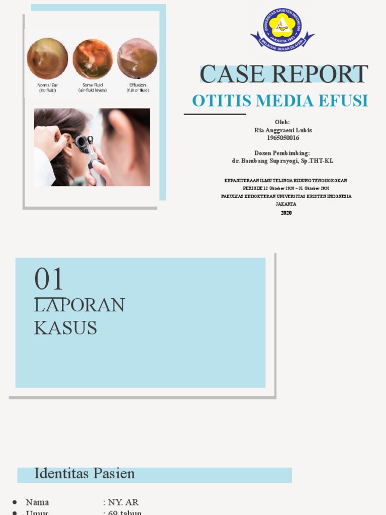 Case Report Otitis Media Efusi | PDF