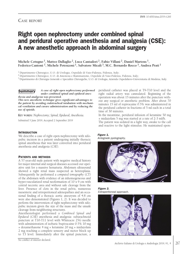 Right Open Nephrectomy Under Combined Spinal and Peridural Operative ...