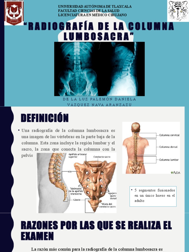 RX Columna Lumbosacra | PDF | La columna vertebral | Vértebra